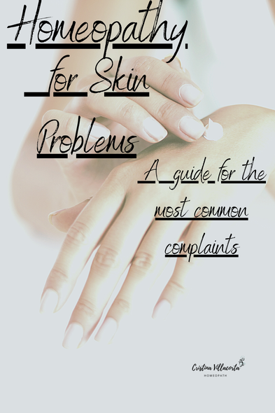 Homeopathy for Itchy Skin and Hives - Cristina Villacorta